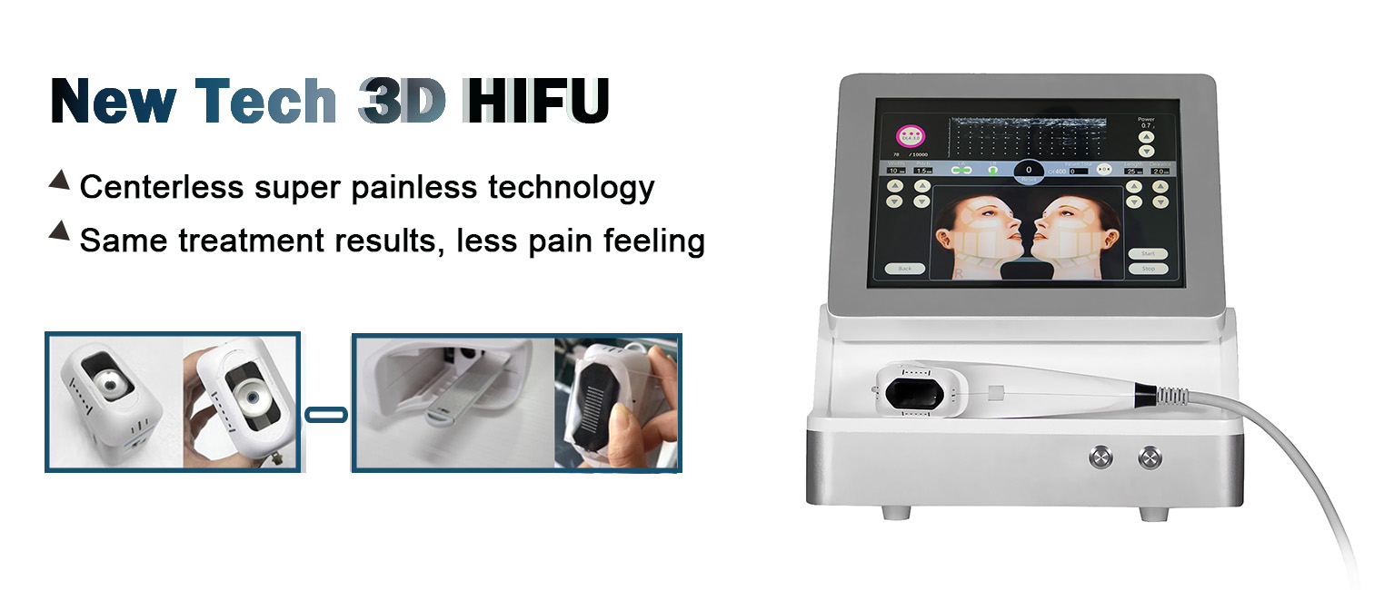 The Effect of Ultra Former 3 HIFU - Beijing VCA Laser Technology Co., Ltd.